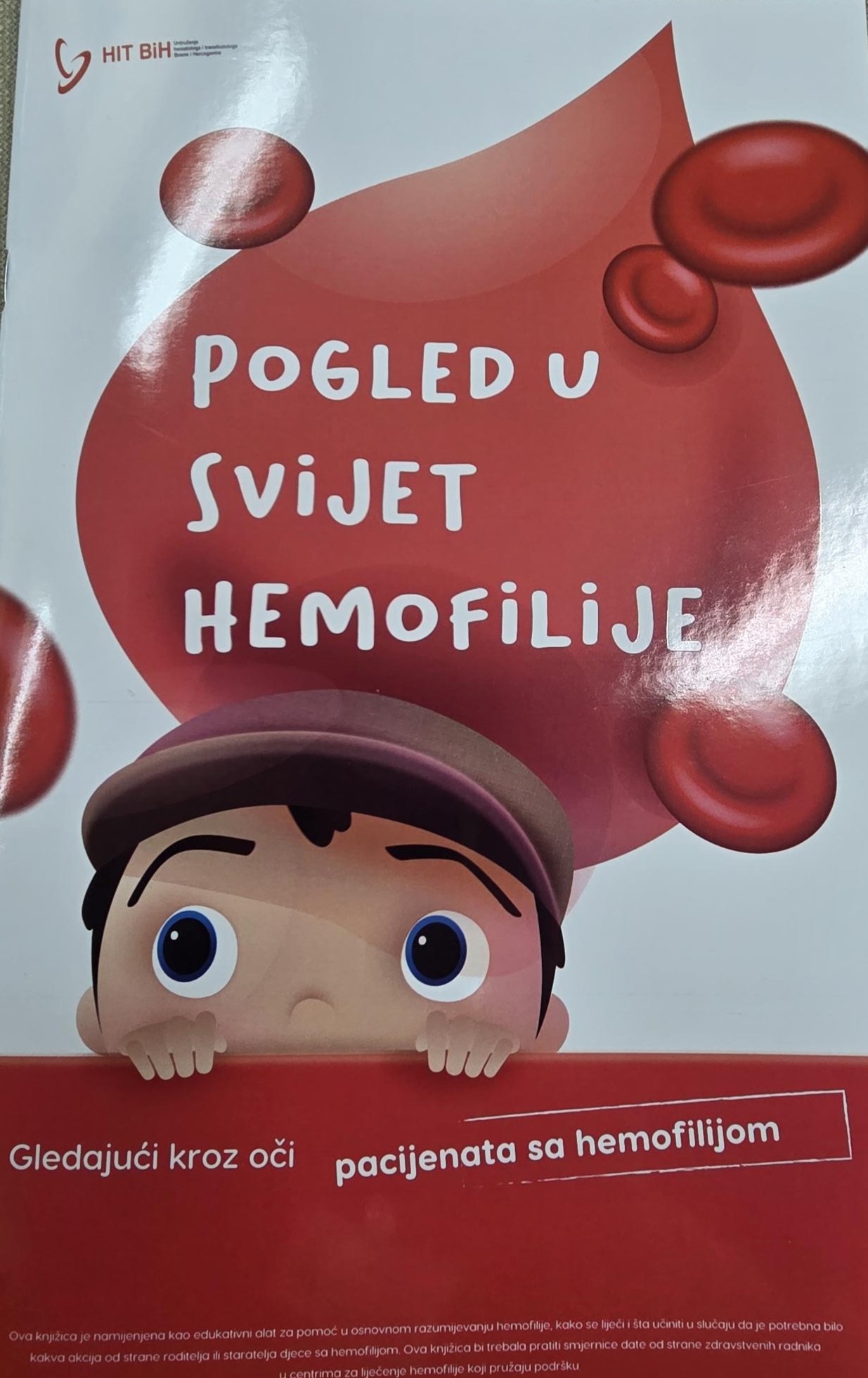 KCUS obilježio Svjetski dan hemofilije - KCUS